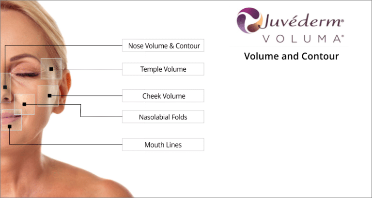 Juvederm Voluma - MagnifaSkin MedSpa | Medical Spa in Wilmington, DE